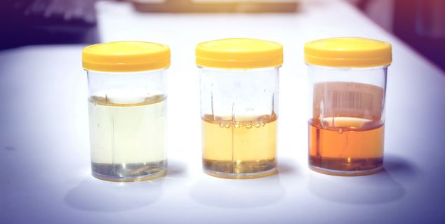 Qué revela el color de la orina sobre tu salud? La guía que no sabías ...
